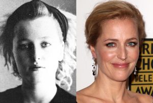 The Right Kind of Changes from Gillian Anderson’s Plastic Surgery | Go ...