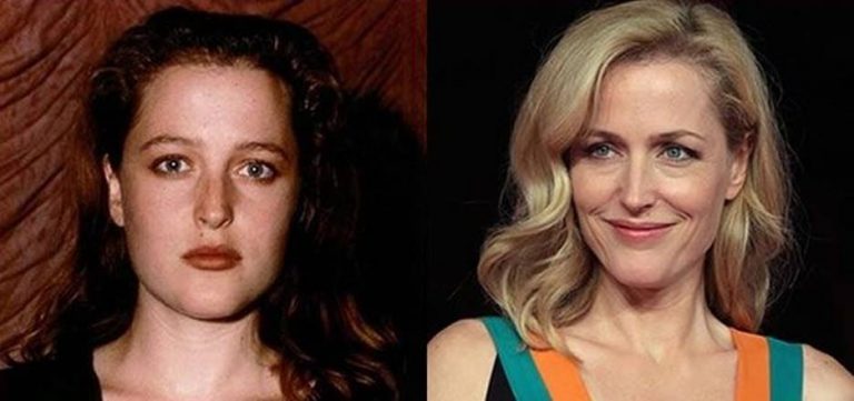 The Right Kind of Changes from Gillian Anderson’s Plastic Surgery | Go ...